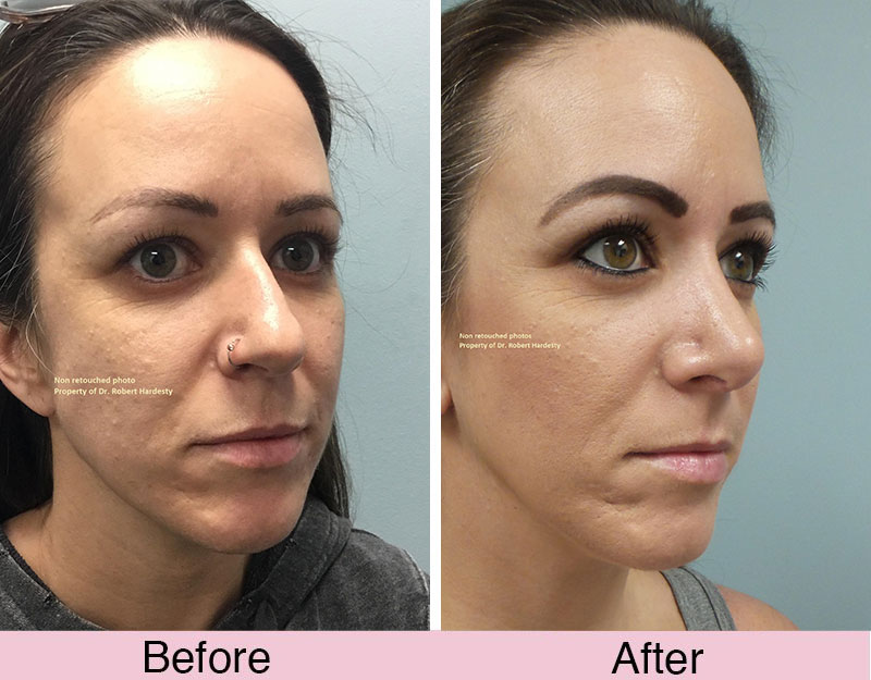 Patient 171171 Before and After Photos Riverside CA